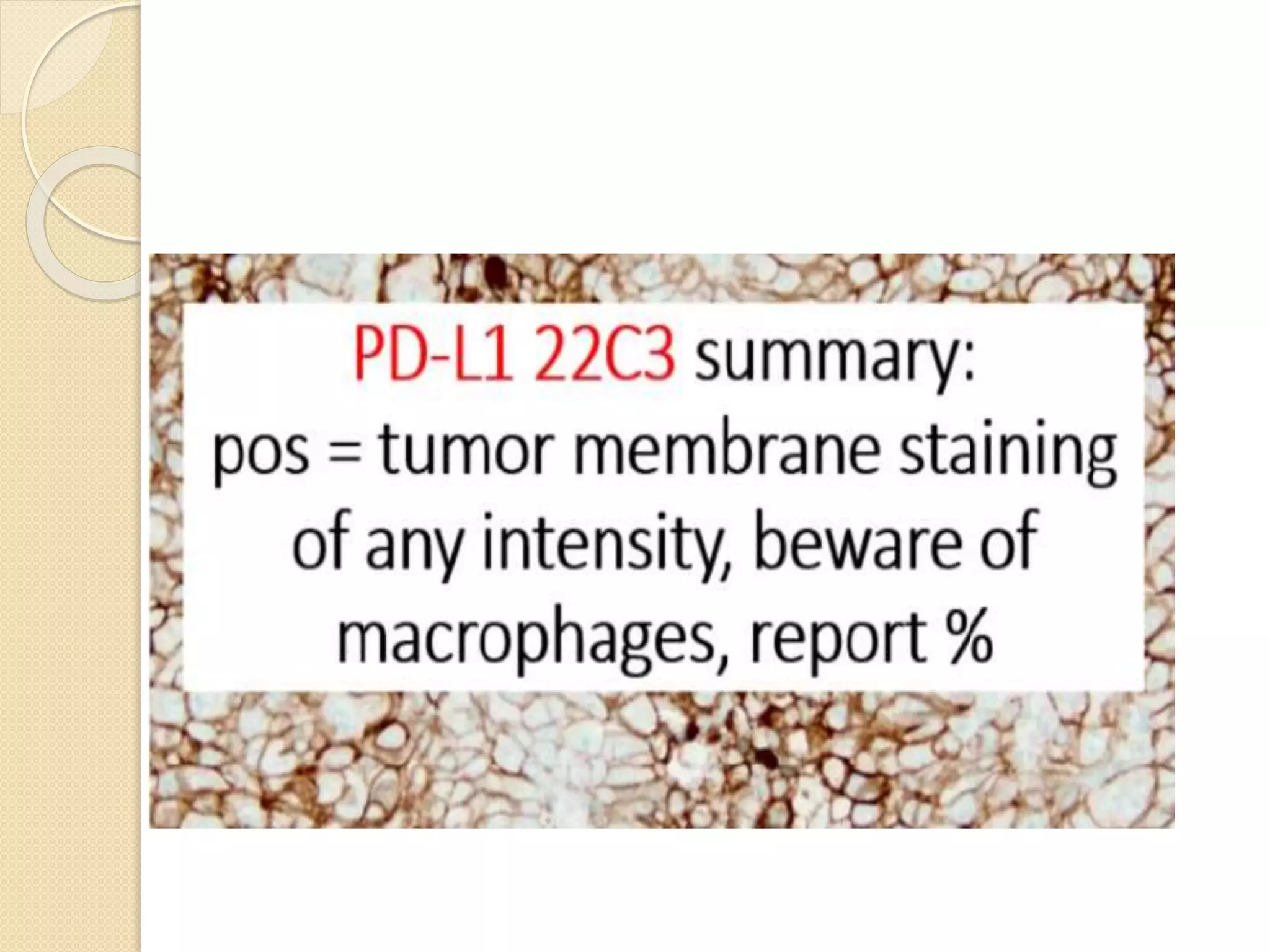 PD-L1 ROLE IN CANCER IMMUNOTHERAPY | PPT