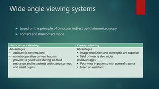viewing systems in vitrectomy | PPTX