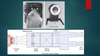 viewing systems in vitrectomy | PPTX