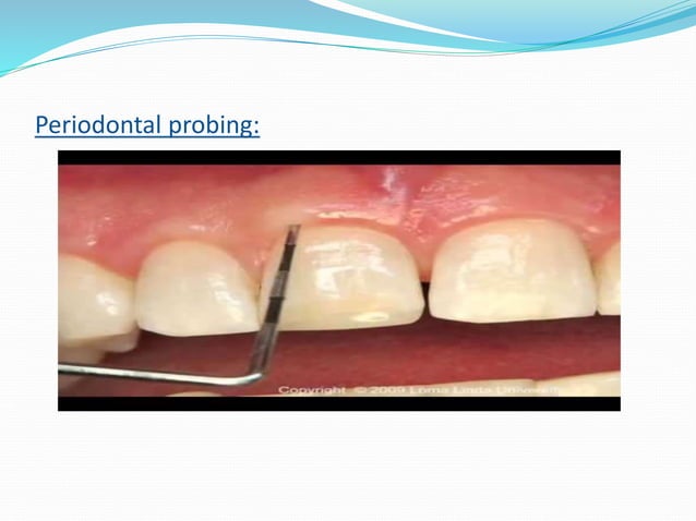 diagnosis of pulpal pathologies | PPTX | Oral care | Personal Care