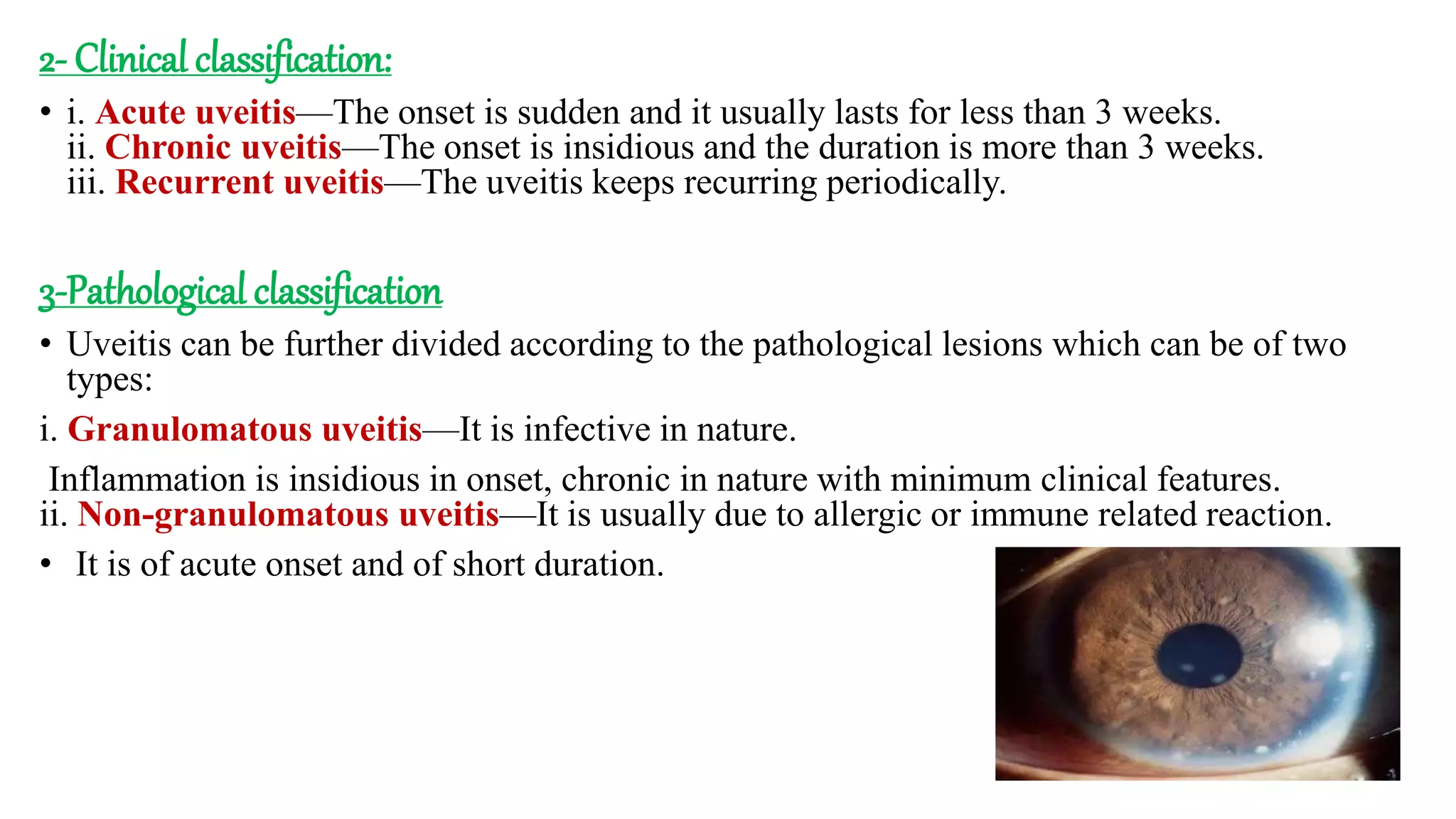 uveitis | PPT