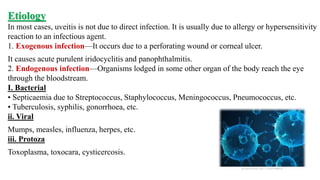 uveitis | PPT