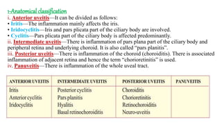 uveitis | PPTX