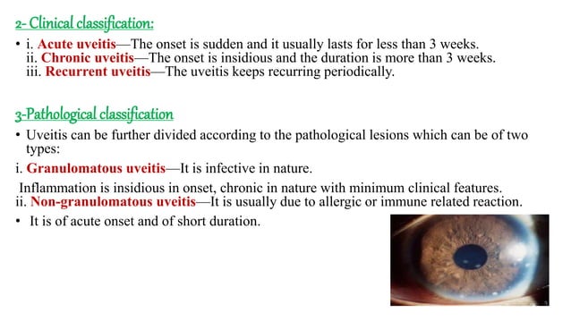 uveitis | PPT