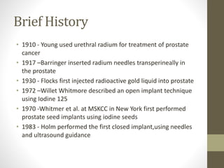 Prostate Cancer Brachytherapy | PPTX