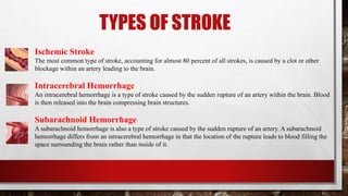 Ischemic Stroke | PPTX