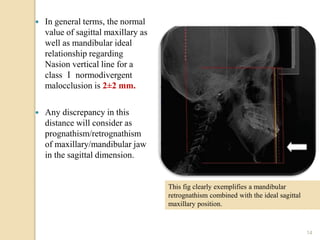 MICROSOFT CEPHALOMETRIC ANALYSIS | PPTX