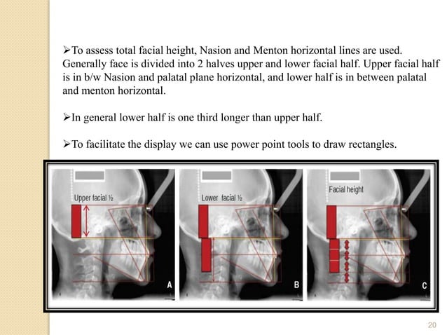 MICROSOFT CEPHALOMETRIC ANALYSIS | PPT