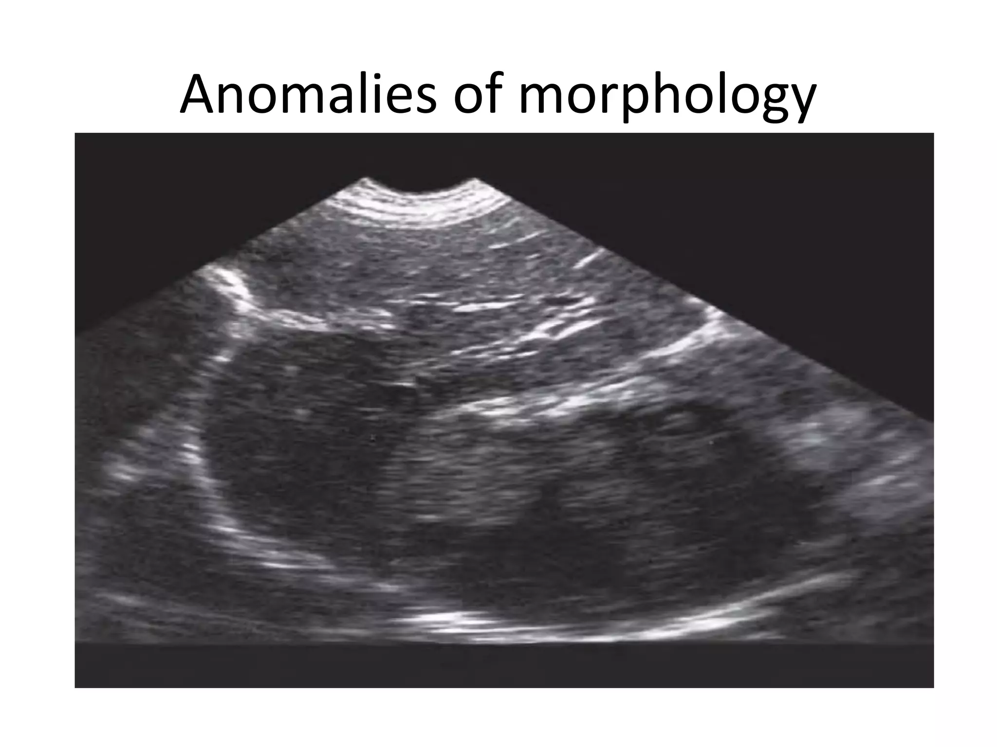 hepatobiliary imaging anatomy, Radiology | PPTX