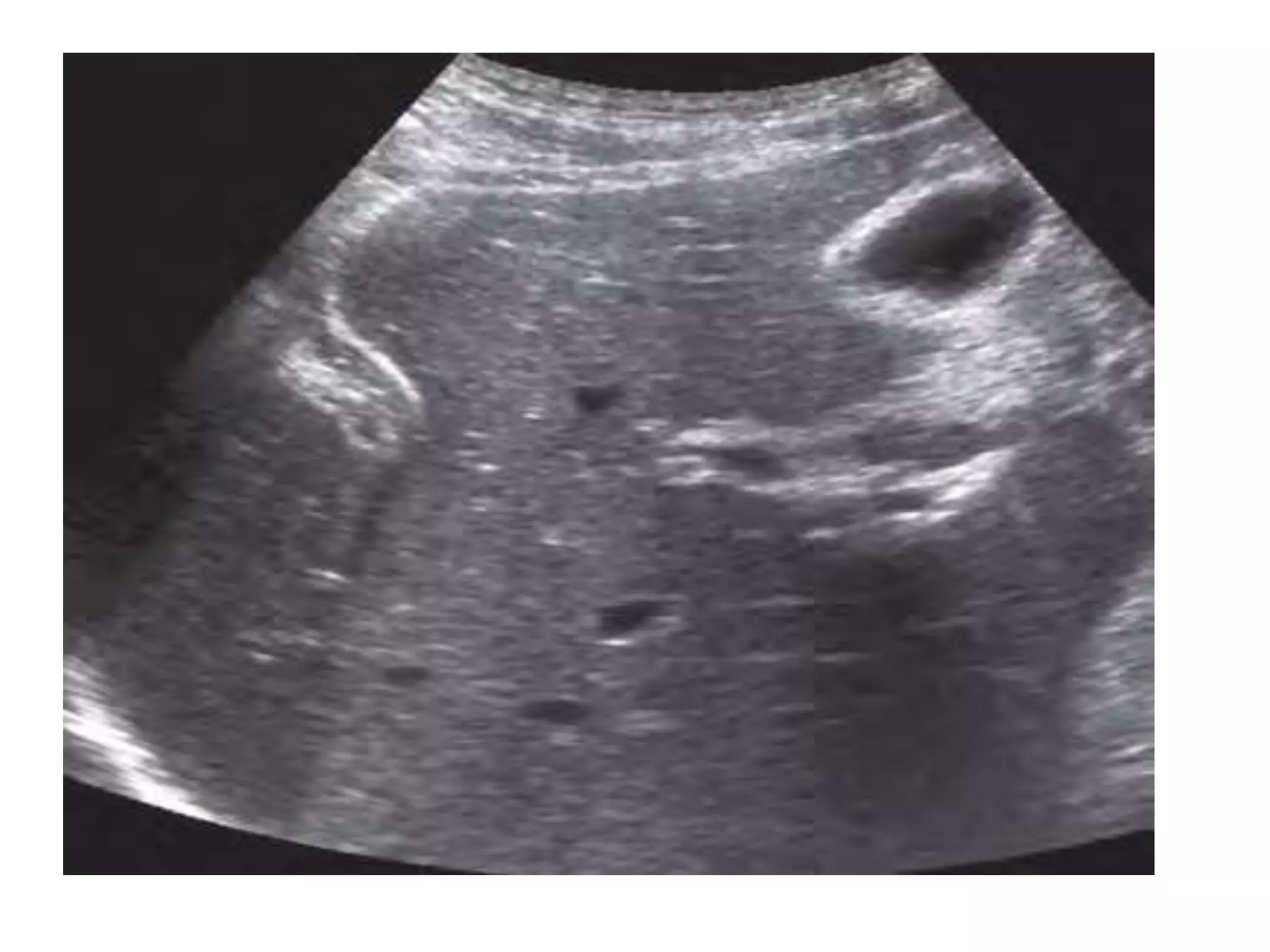 hepatobiliary imaging anatomy, Radiology | PPTX