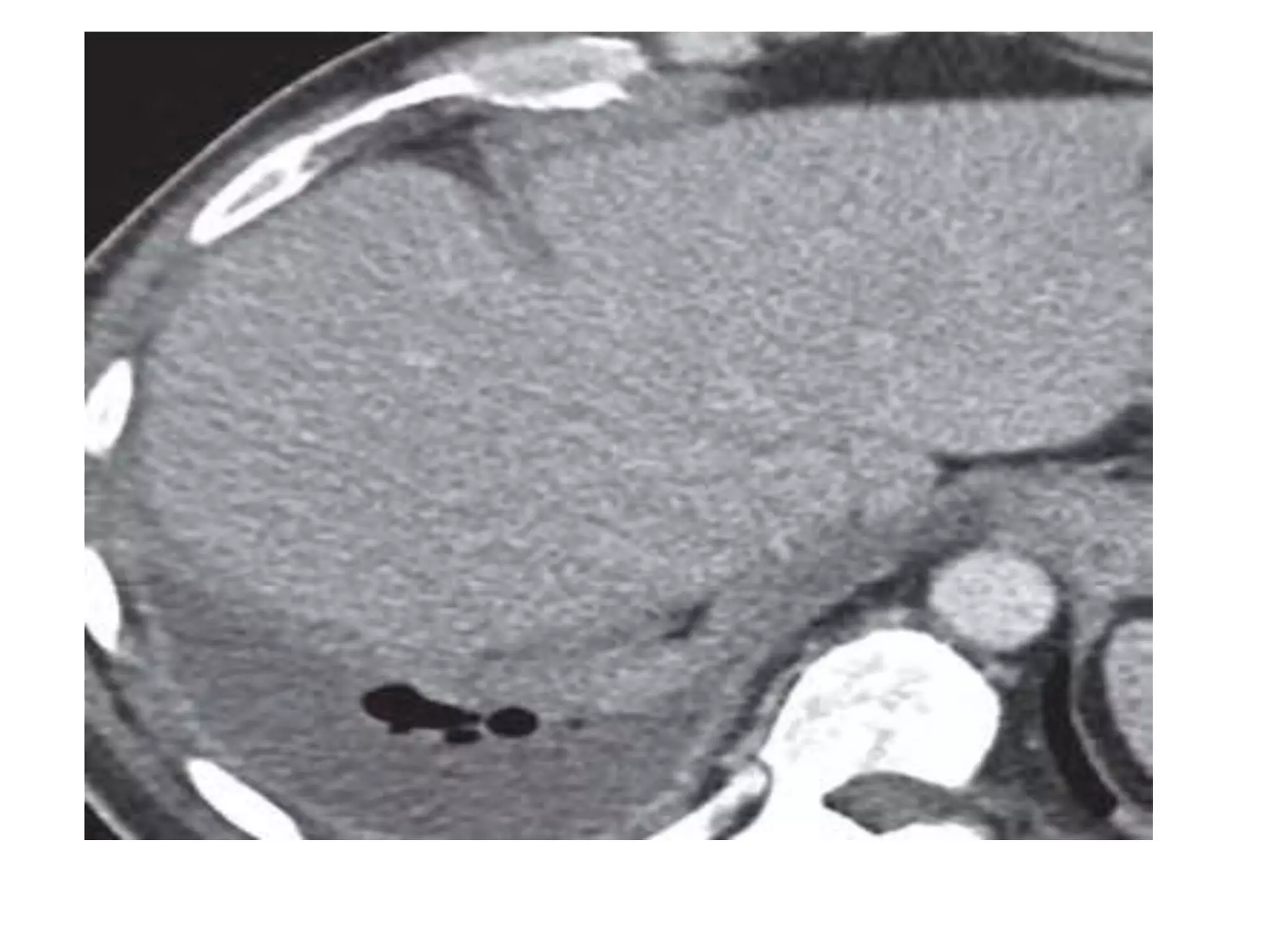 hepatobiliary imaging anatomy, Radiology | PPTX