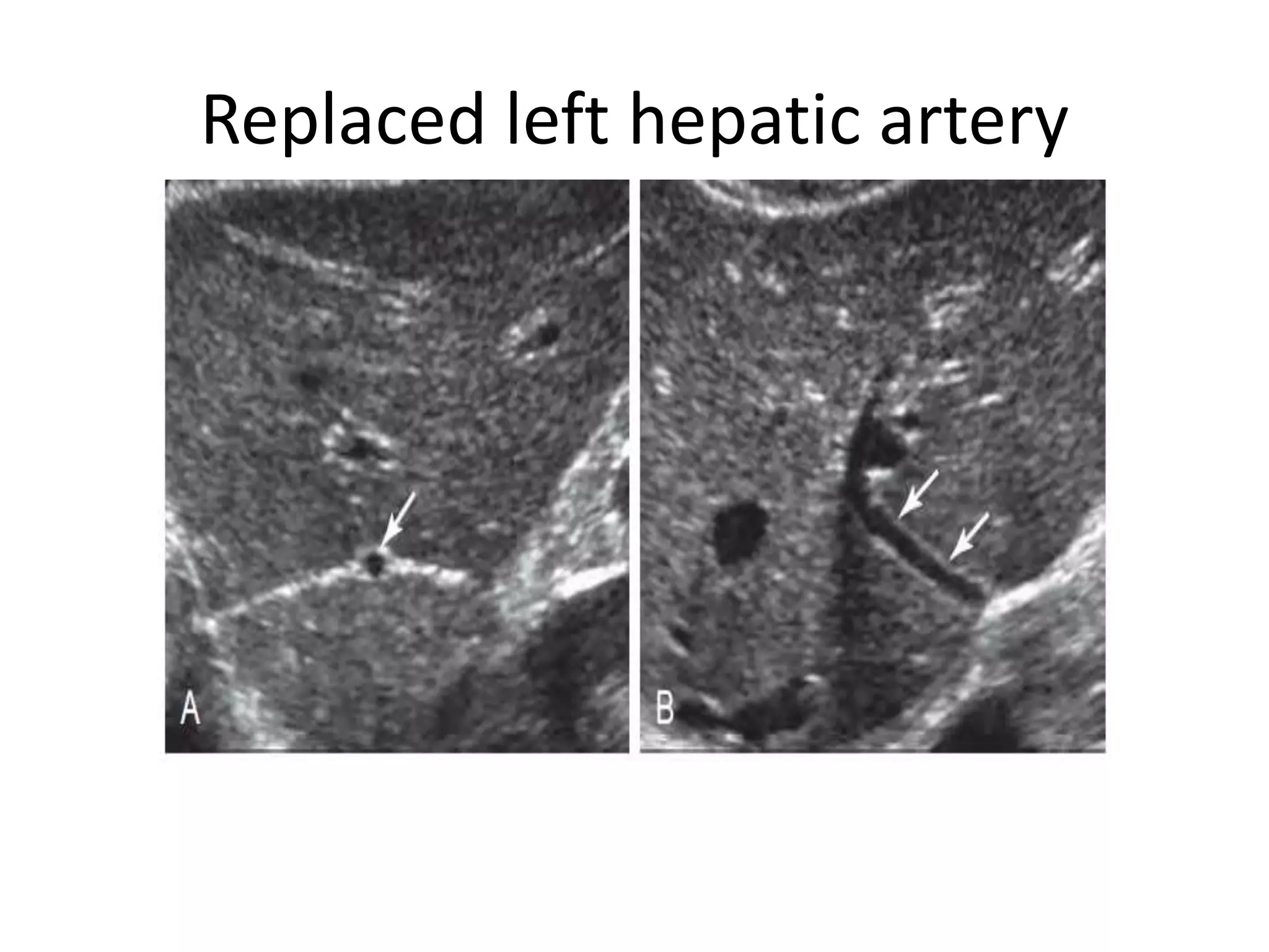 hepatobiliary imaging anatomy, Radiology | PPTX