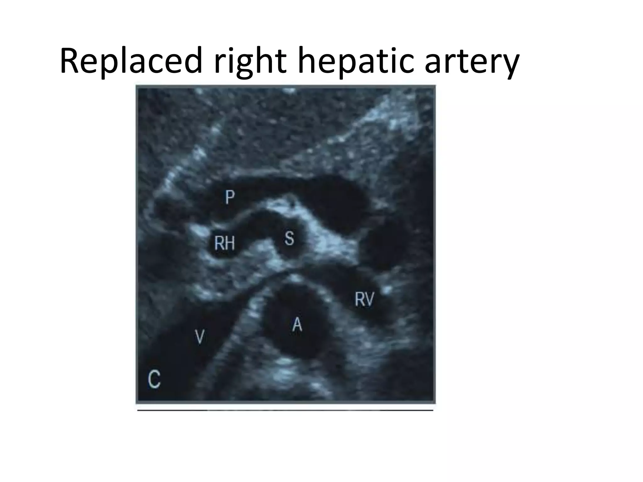 hepatobiliary imaging anatomy, Radiology | PPTX
