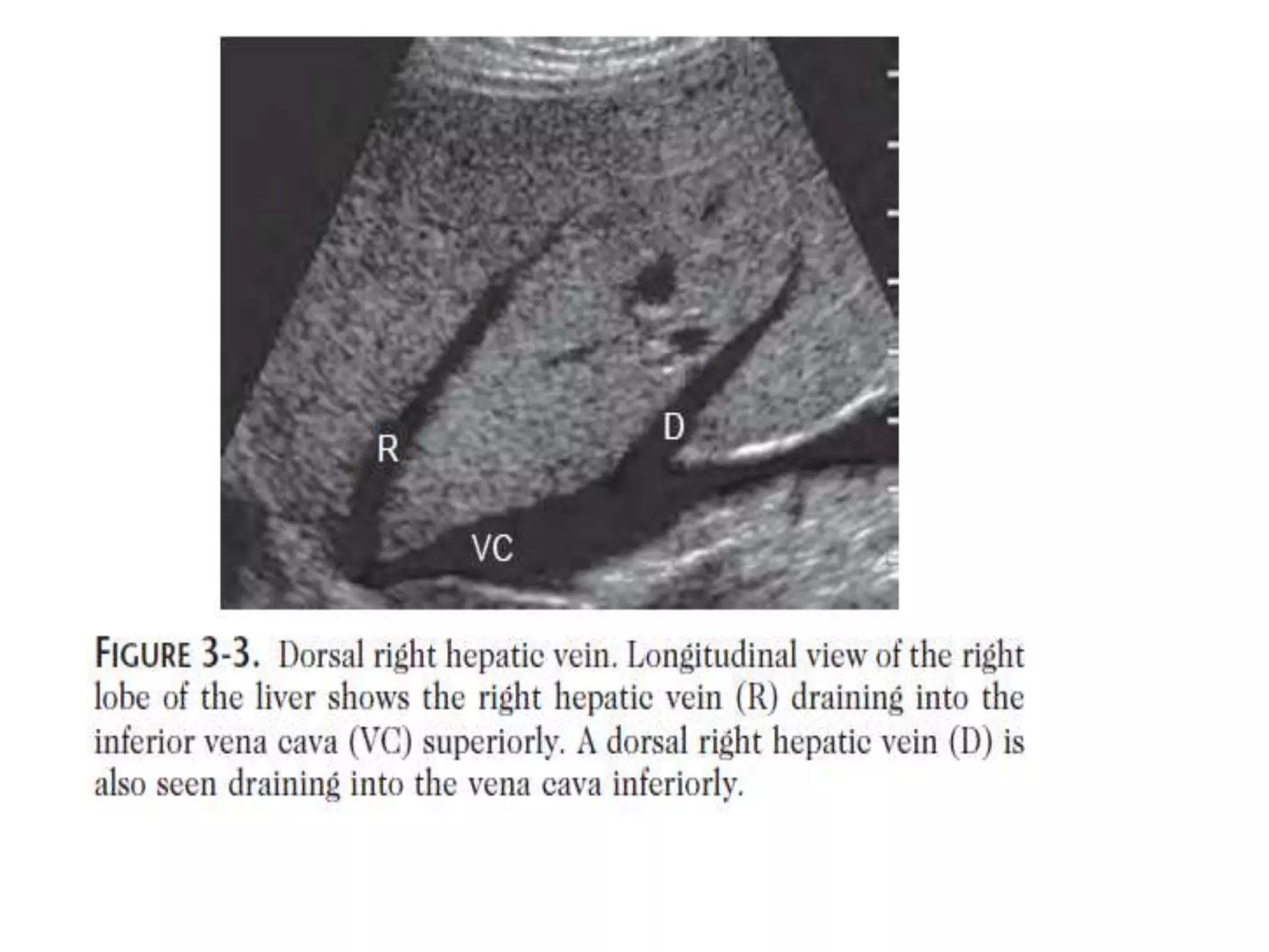 hepatobiliary imaging anatomy, Radiology | PPTX