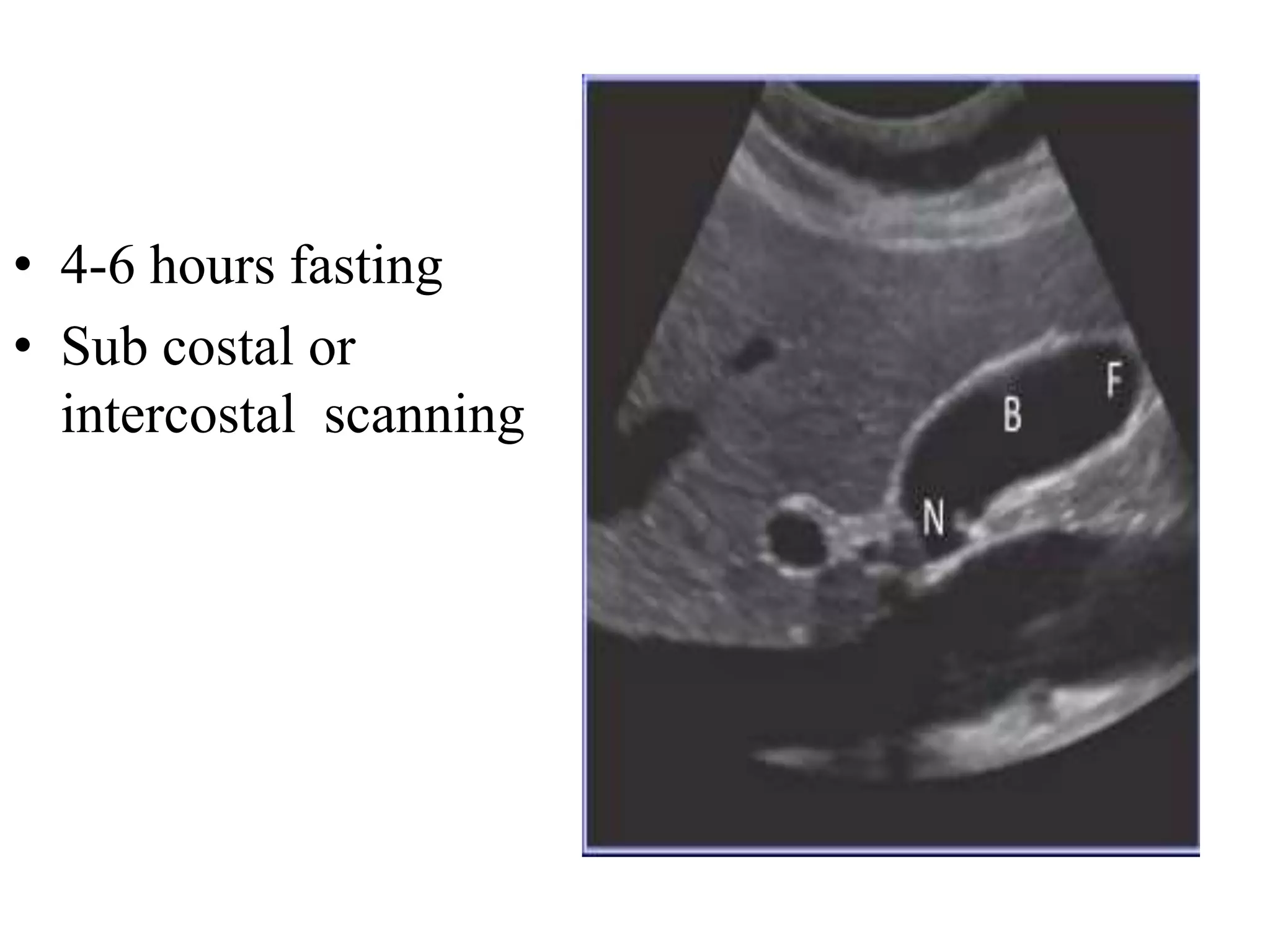 hepatobiliary imaging anatomy, Radiology | PPTX