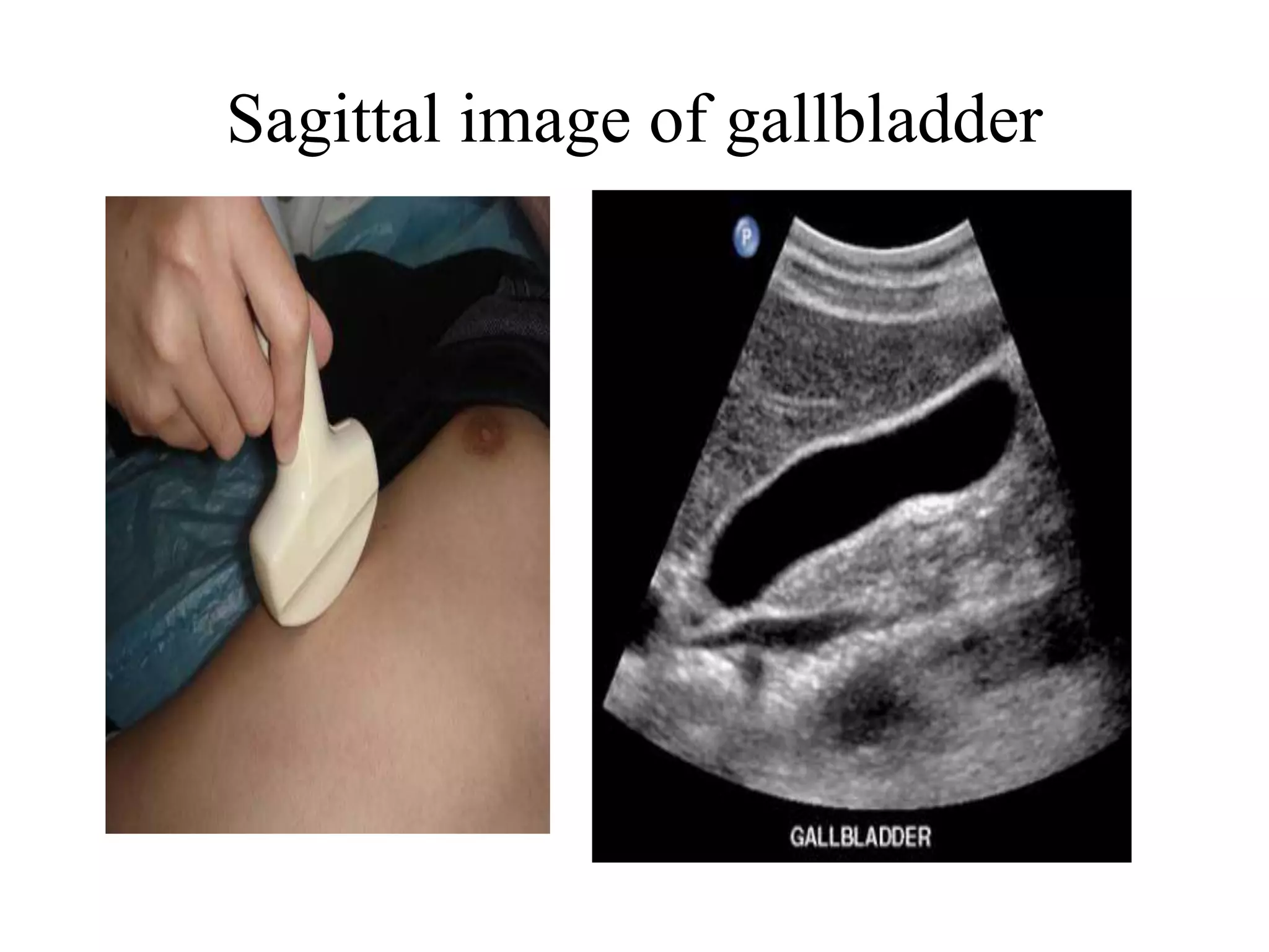 hepatobiliary imaging anatomy, Radiology | PPTX