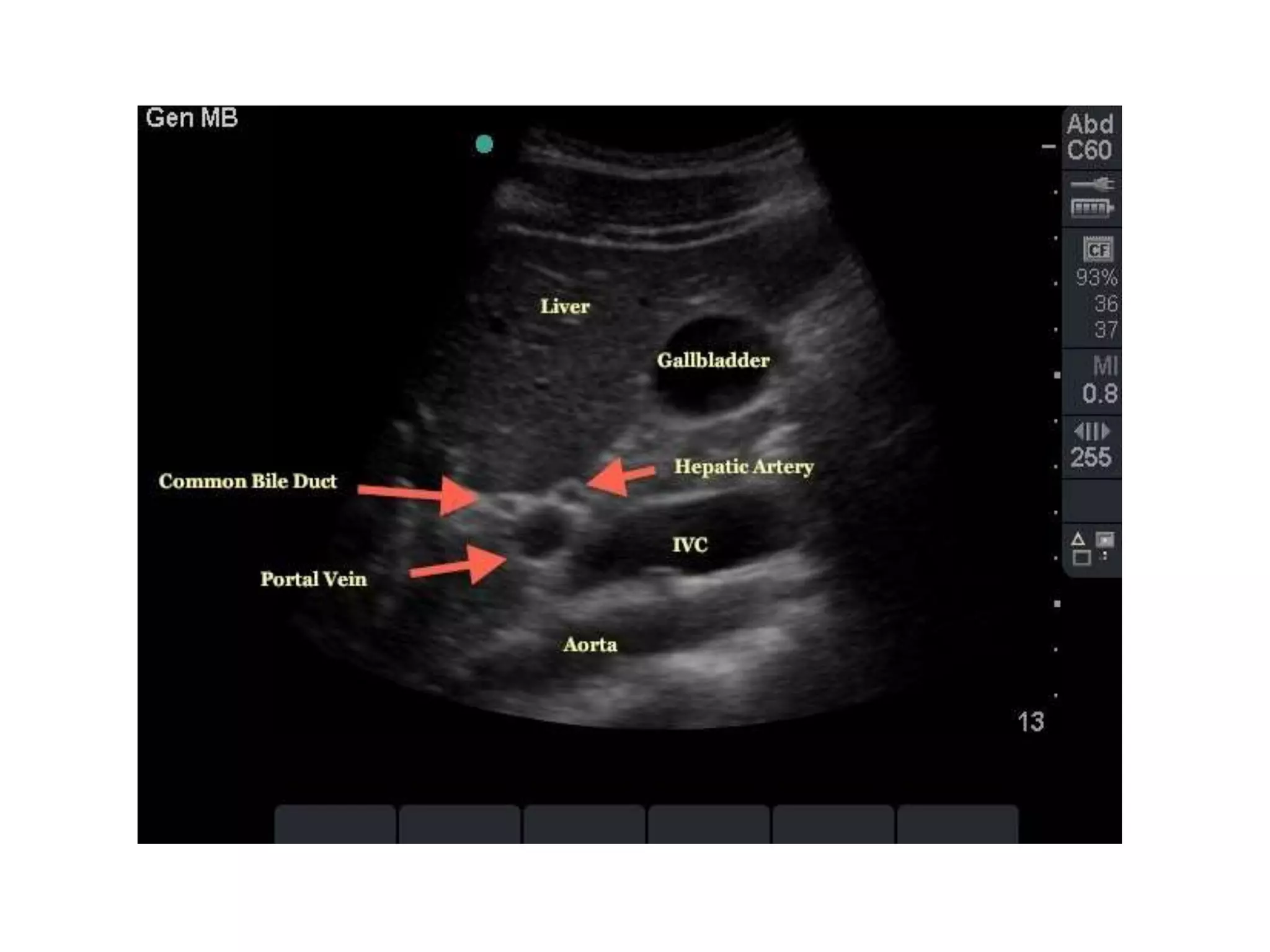 hepatobiliary imaging anatomy, Radiology | PPTX
