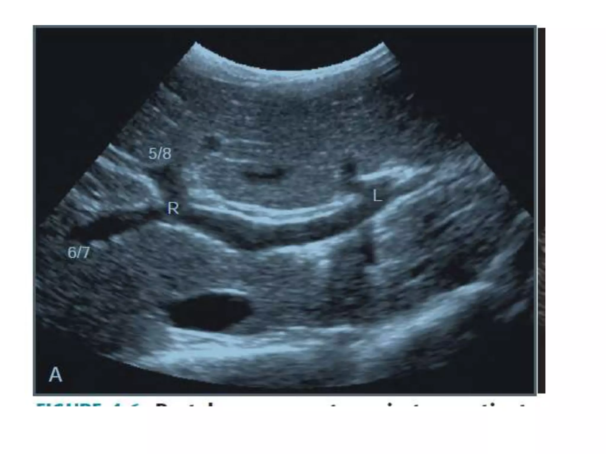 hepatobiliary imaging anatomy, Radiology | PPTX