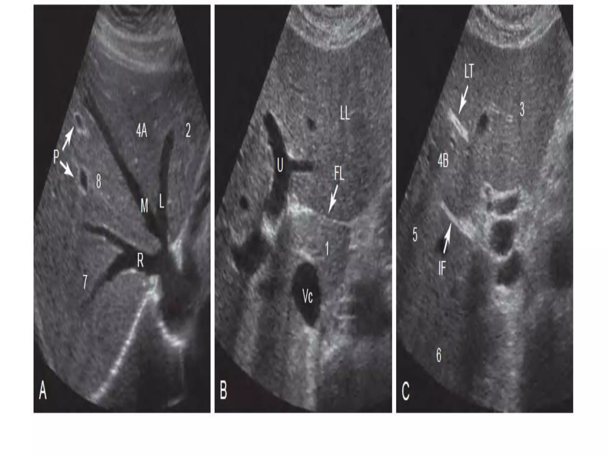 hepatobiliary imaging anatomy, Radiology | PPTX