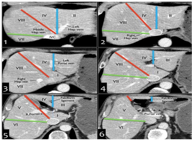 hepatobiliary imaging anatomy, Radiology | PPTX