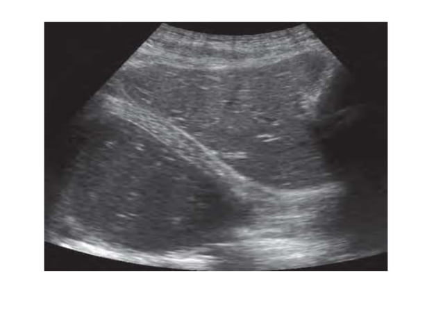 hepatobiliary imaging anatomy, Radiology | PPTX
