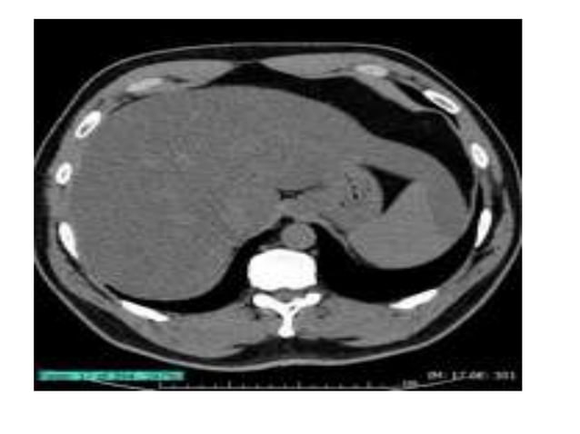 hepatobiliary imaging anatomy, Radiology | PPTX