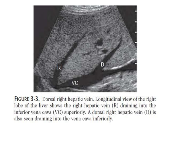 hepatobiliary imaging anatomy, Radiology | PPTX