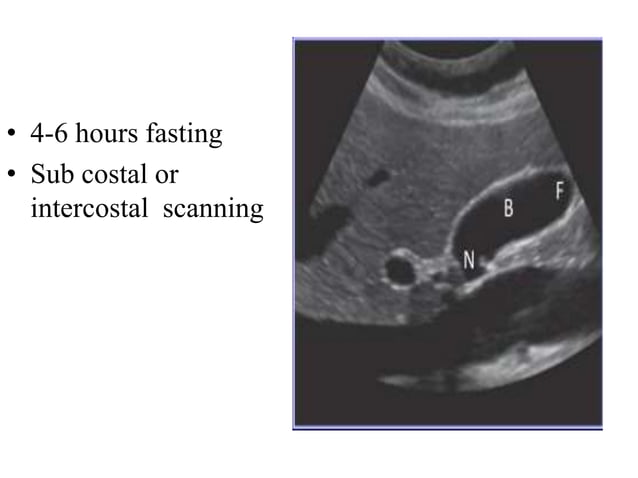 hepatobiliary imaging anatomy, Radiology | PPTX