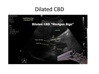 hepatobiliary imaging anatomy, Radiology | PPTX