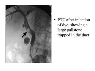 hepatobiliary imaging anatomy, Radiology | PPTX