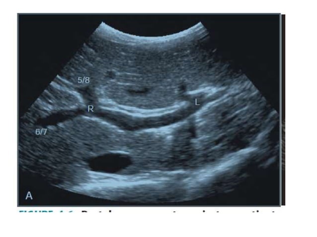 hepatobiliary imaging anatomy, Radiology | PPTX