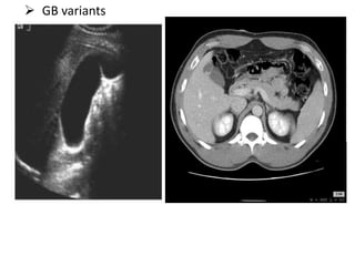hepatobiliary imaging anatomy, Radiology | PPTX