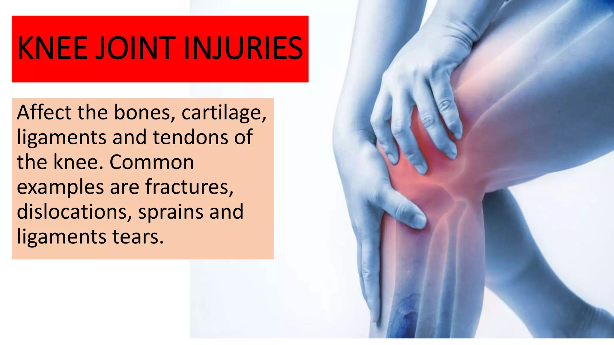 Common Sports Injuries | PPT