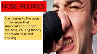 Common Sports Injuries | PPT