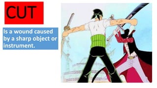 Common Sports Injuries | PPT