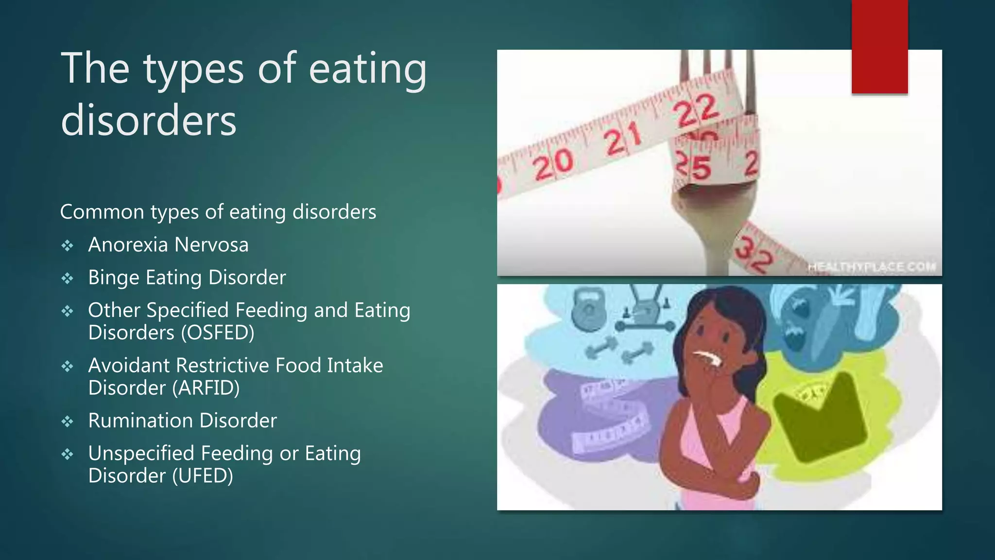 eating disorders | PPTX