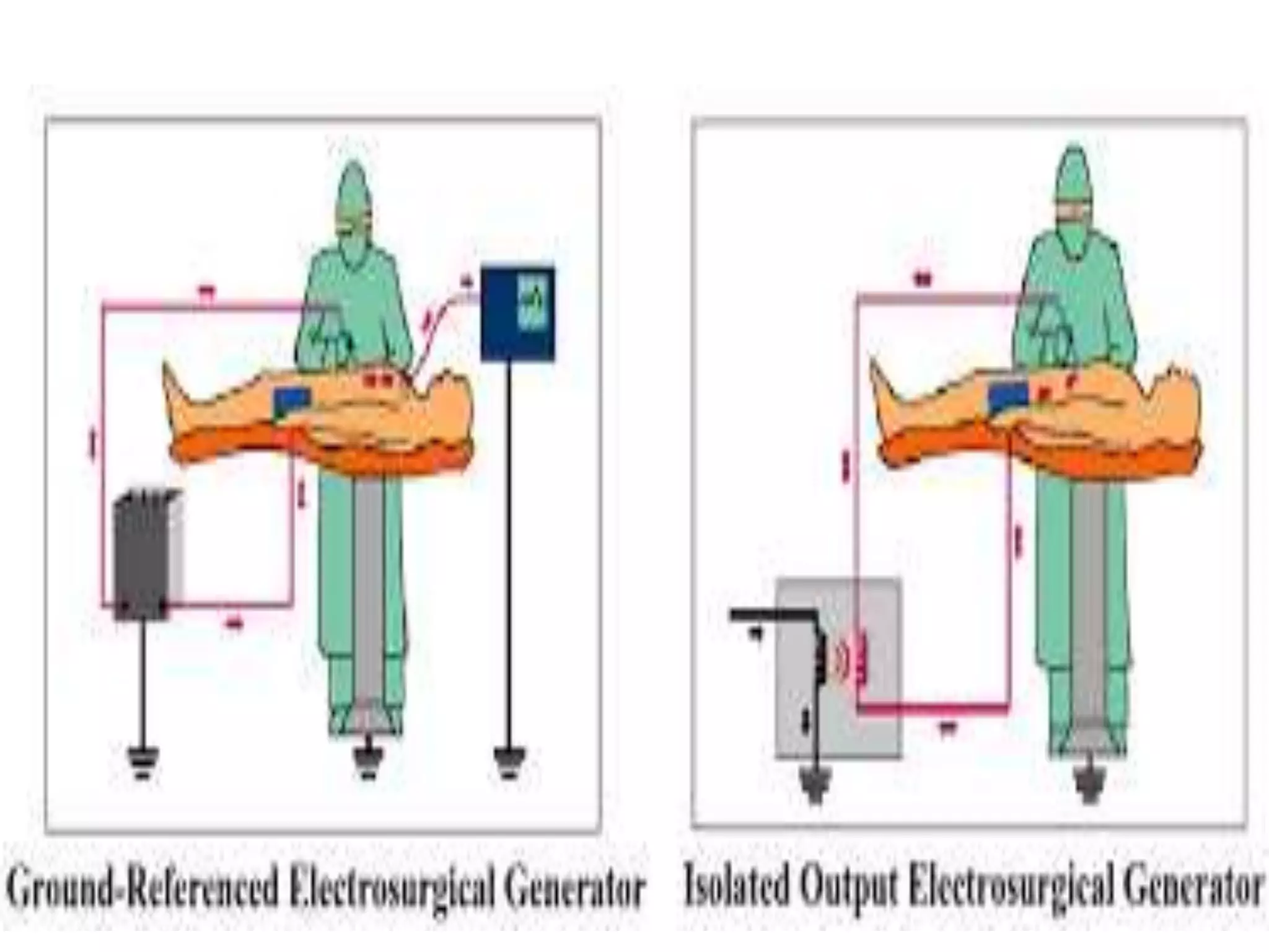 ENERGY DEVICES IN SURGERY | PPTX