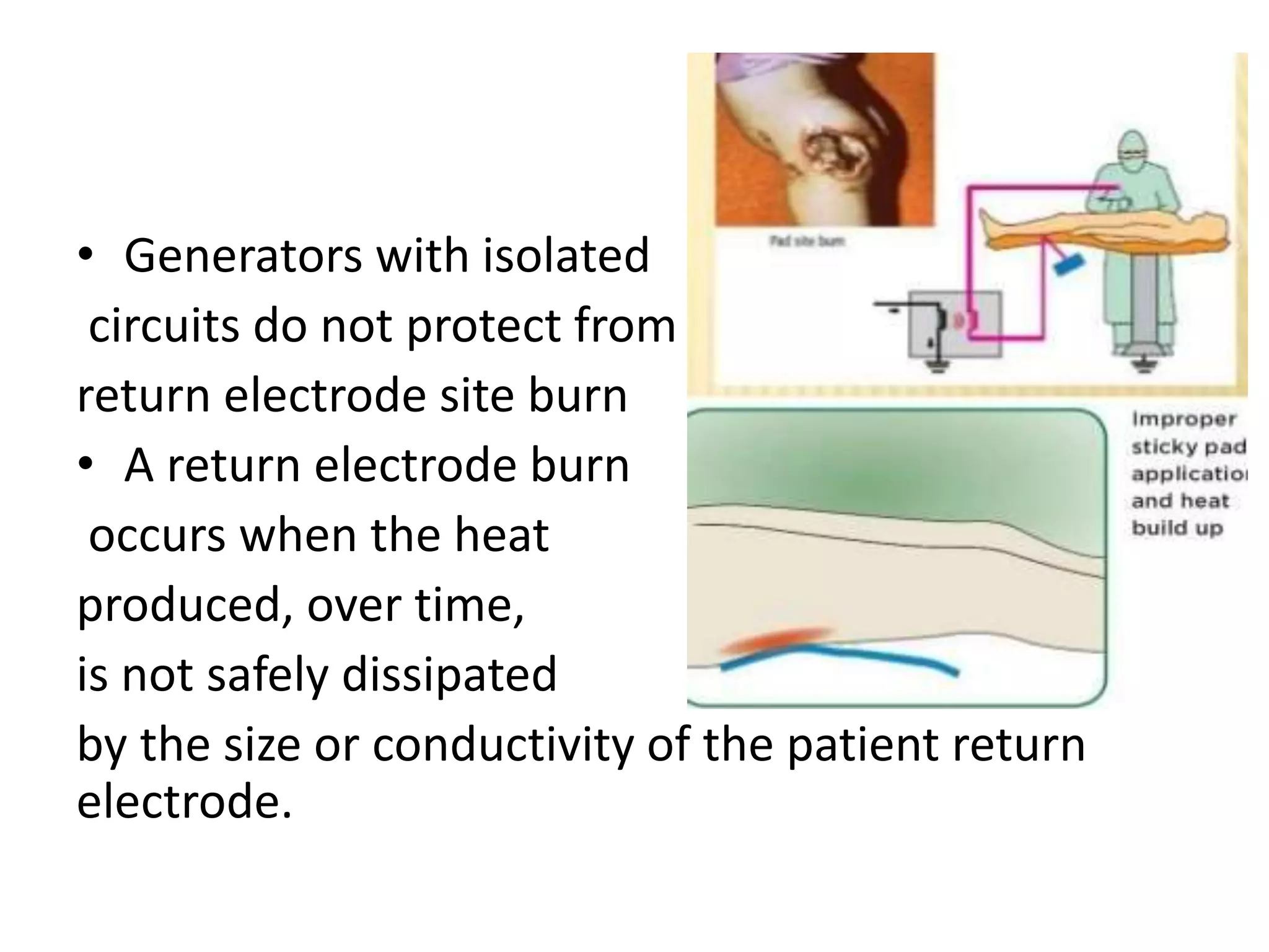 ENERGY DEVICES IN SURGERY | PPTX