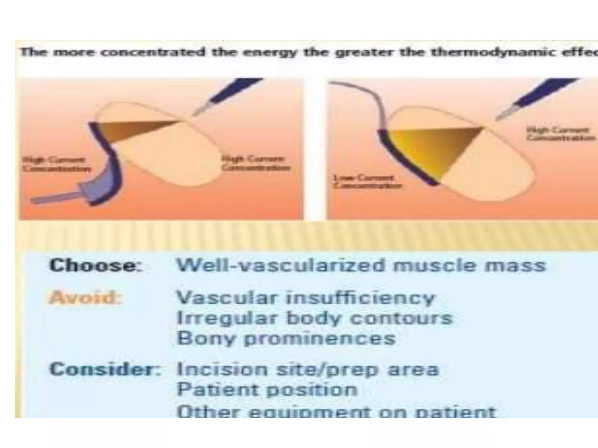 ENERGY DEVICES IN SURGERY | PPTX