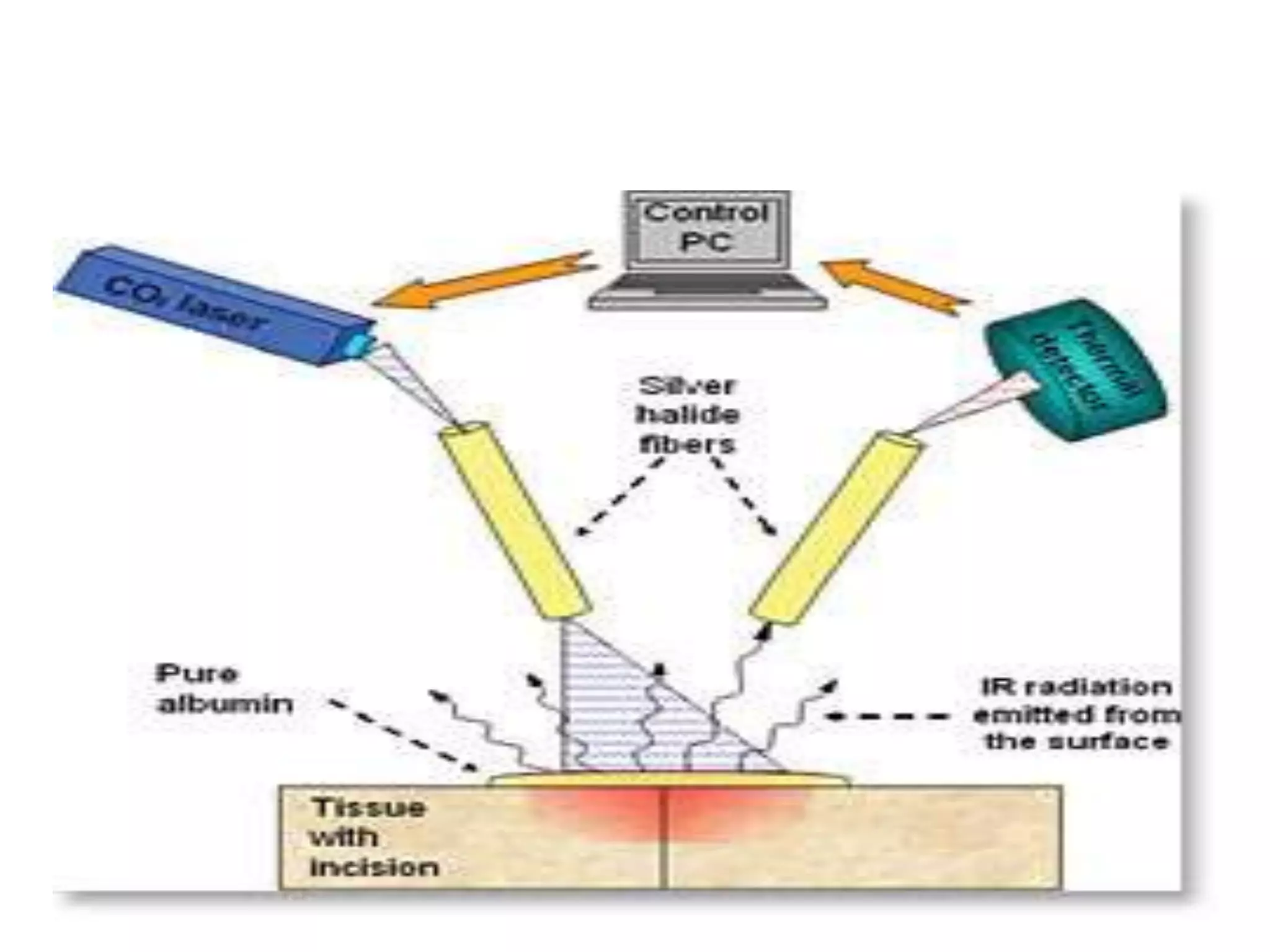 ENERGY DEVICES IN SURGERY | PPTX