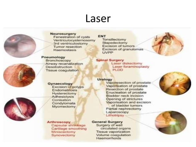 ENERGY DEVICES IN SURGERY | PPTX | First Aid | Injuries