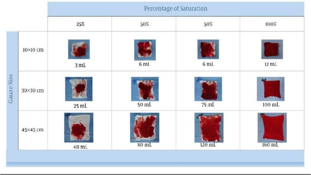 Post Partum Hemorrhage | PPTX