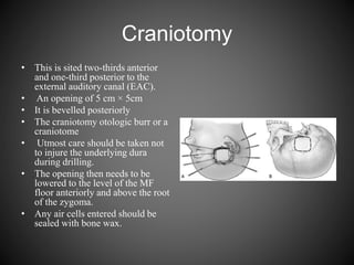 middle fossa surgery | PPT