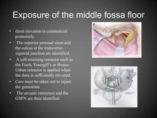 middle fossa surgery | PPT