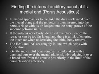 middle fossa surgery | PPT