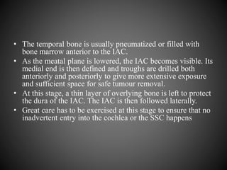 middle fossa surgery | PPT