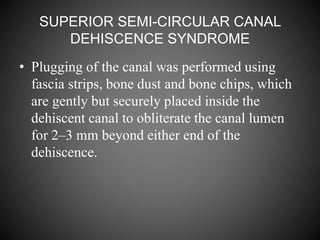 middle fossa surgery | PPT