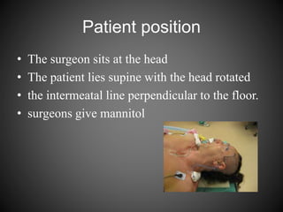 middle fossa surgery | PPT