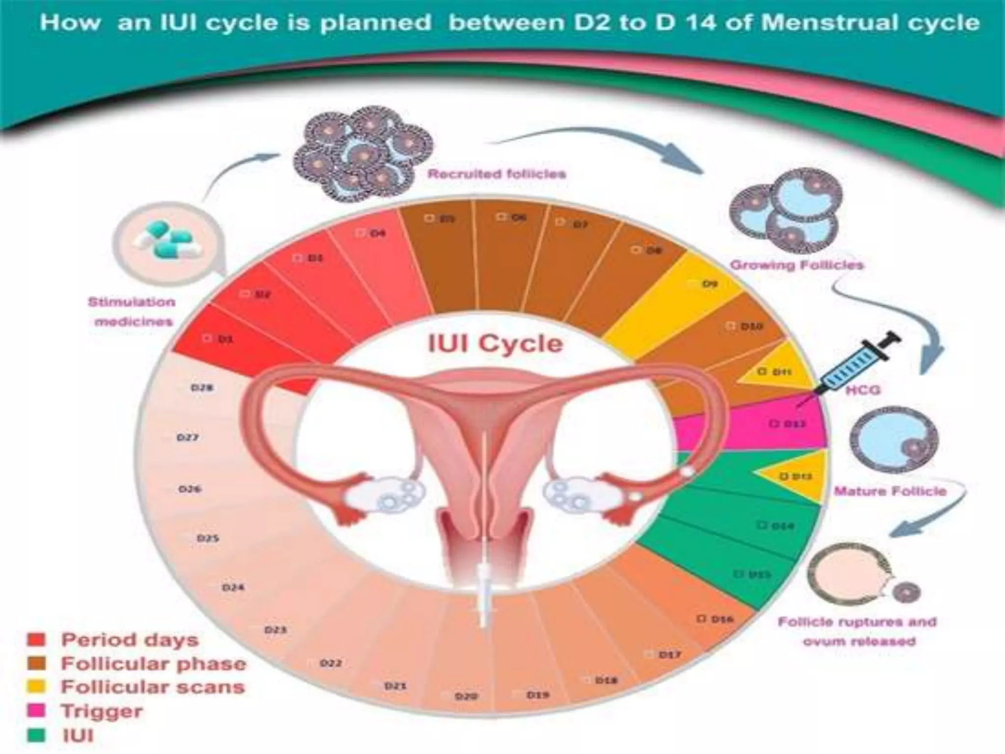Predictive Factors influencing pregnancy rate after intrauterine ...