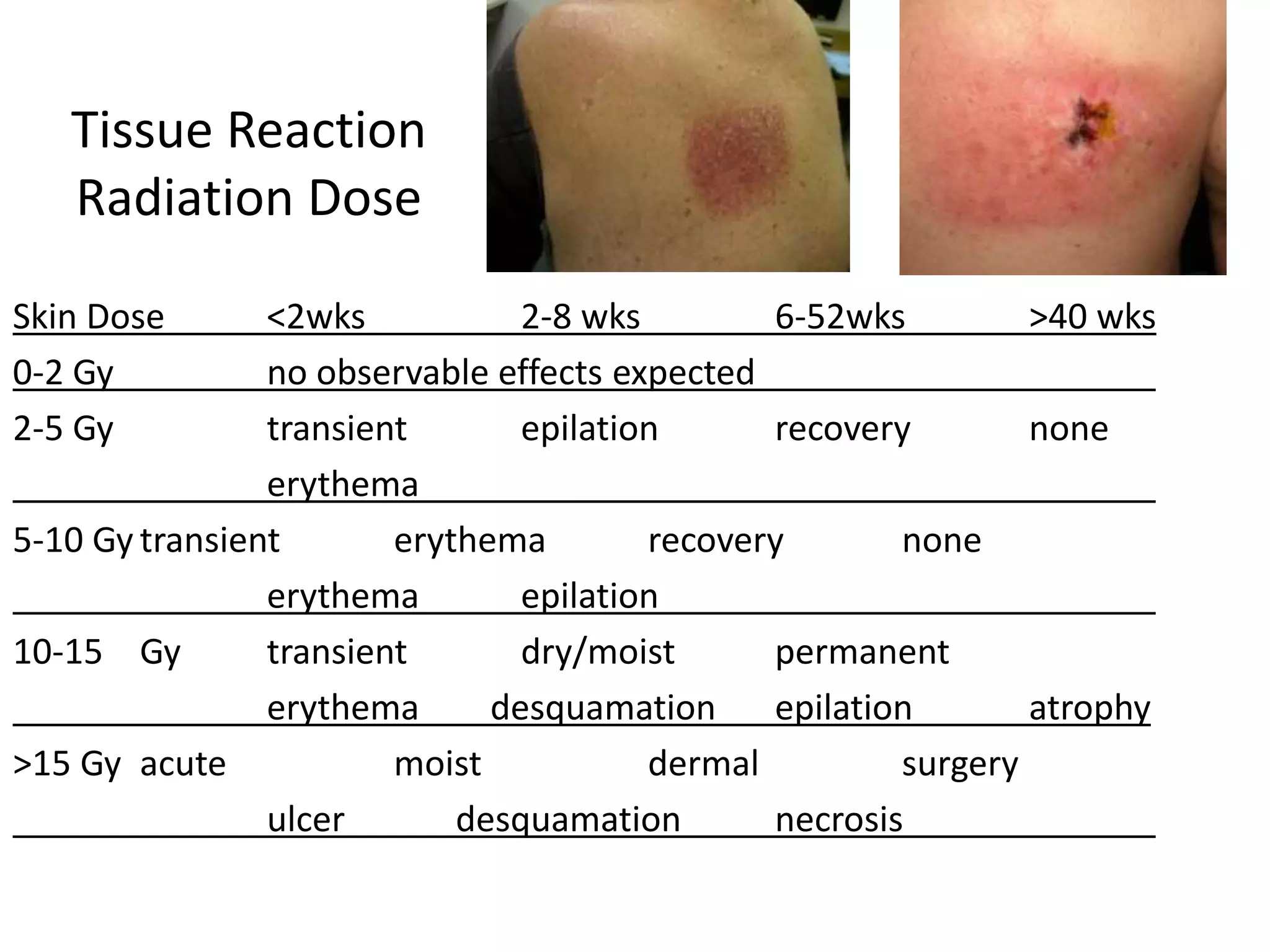 RADIATION SAFETY IN CATHLAB | PPTX